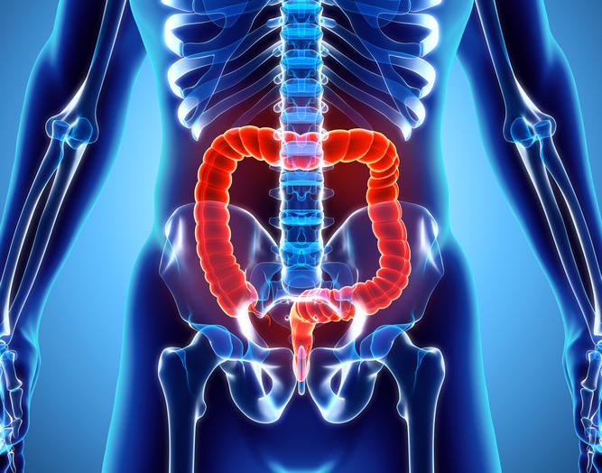 Diverticolosi (sigma e colon): sintomi, dieta e cura - The Wom Healthy