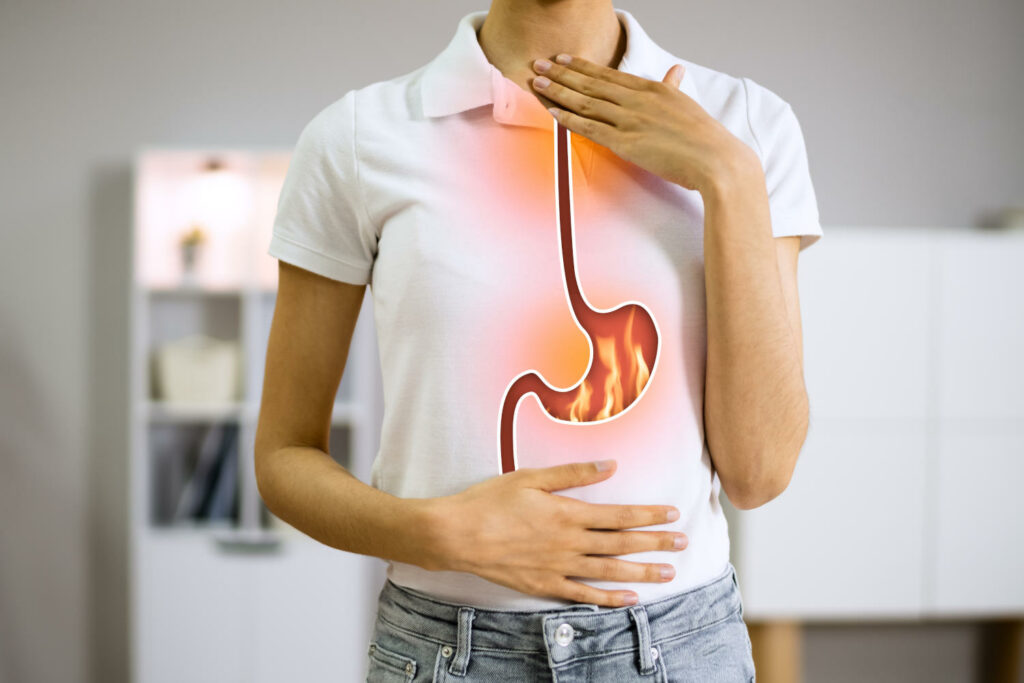 Omeprazolo: a cosa serve e altre domande frequenti - The Wom Healthy