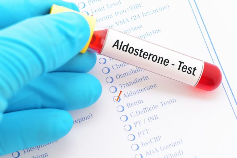 Aldosterone: la sua funzione ed i rischi di un valore alto - The Wom ...