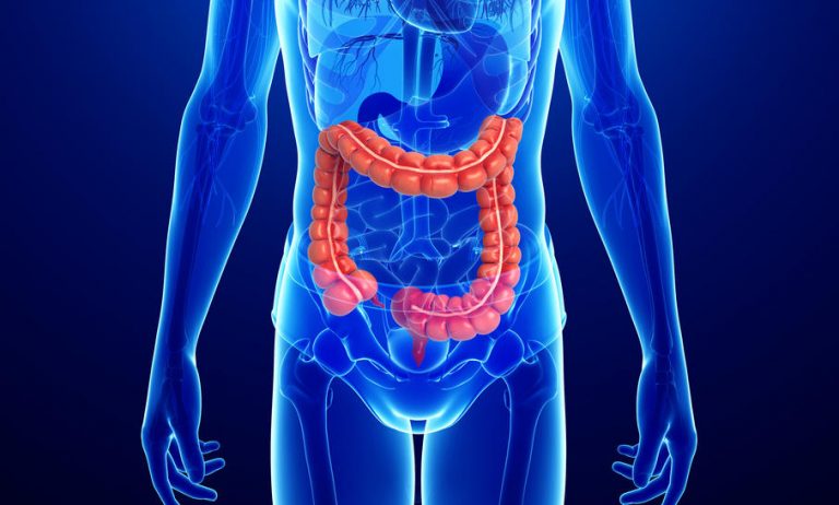 Dolicocolon: sintomi, cura, dieta, conseguenze
