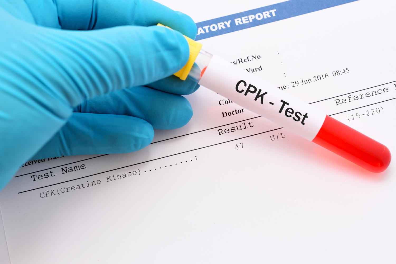 Analisi Del CPK E CK Nel Sangue Valore Alto Basso E Normale Analisi Del CPK E CK Nel Sangue Valore Alto Basso E Normale